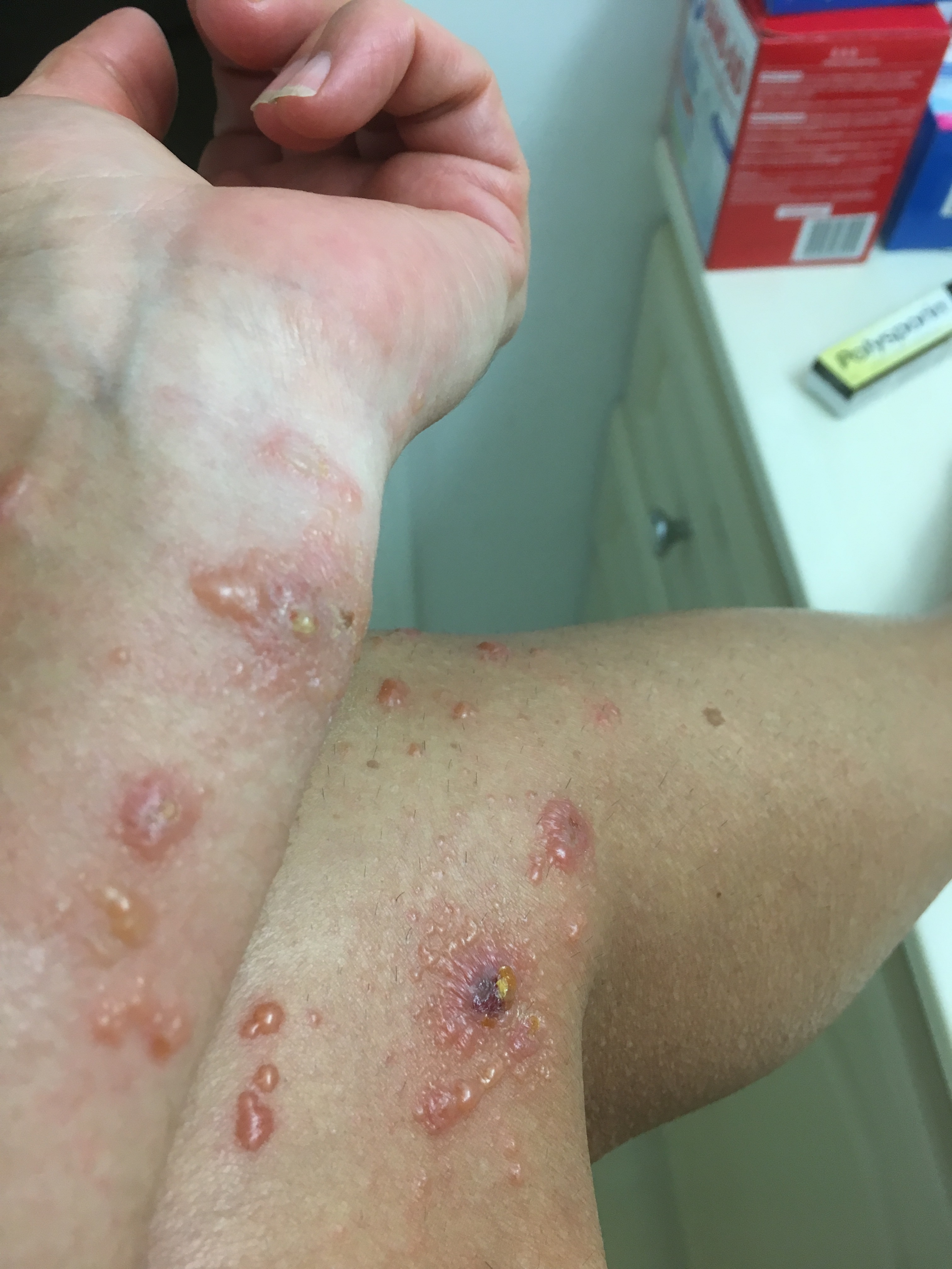 Poisonous to Touch Weed Series: Poison Ivy (Toxicodendron radicans and ...