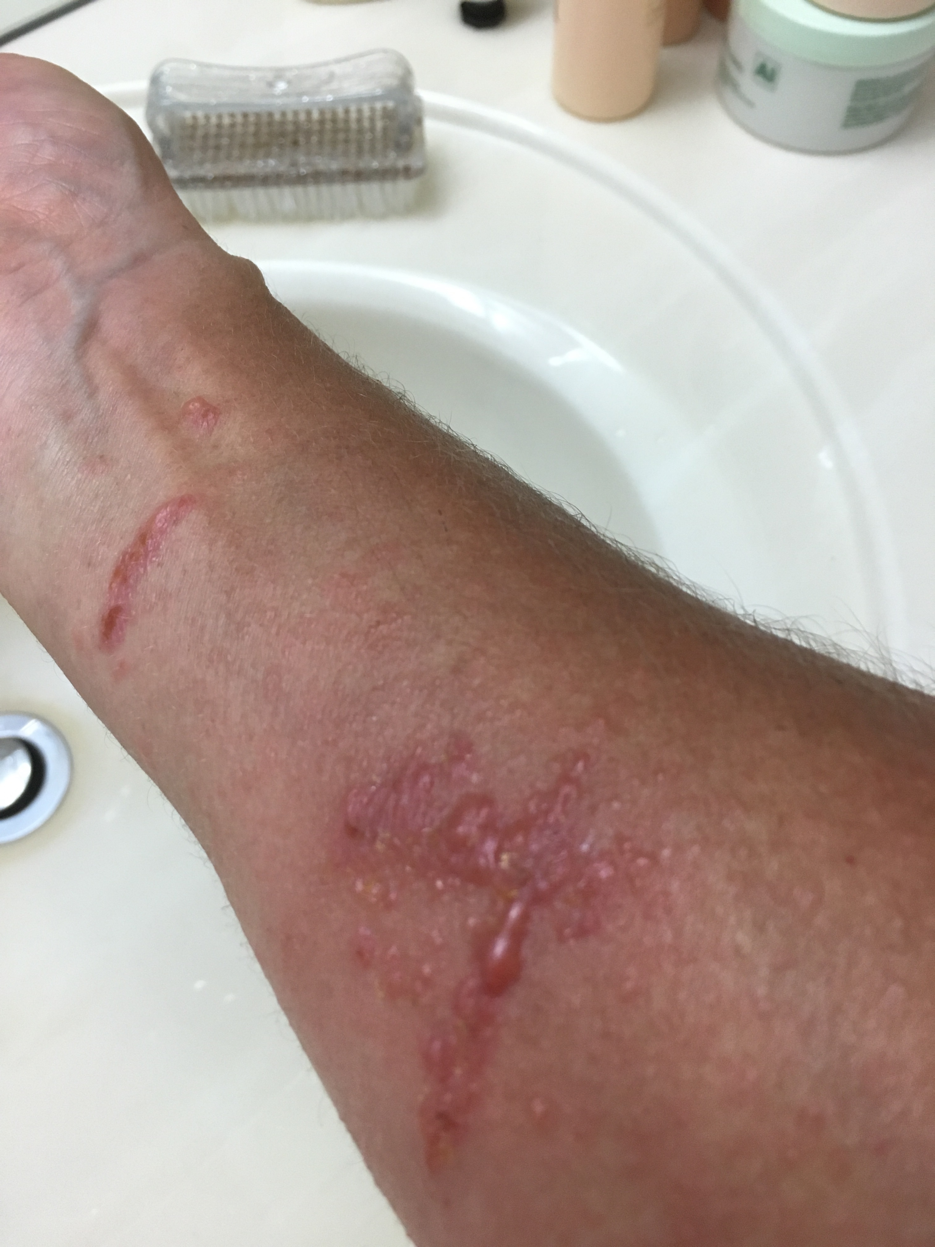 Poisonous to Touch Weed Series: Poison Ivy (Toxicodendron radicans and ...