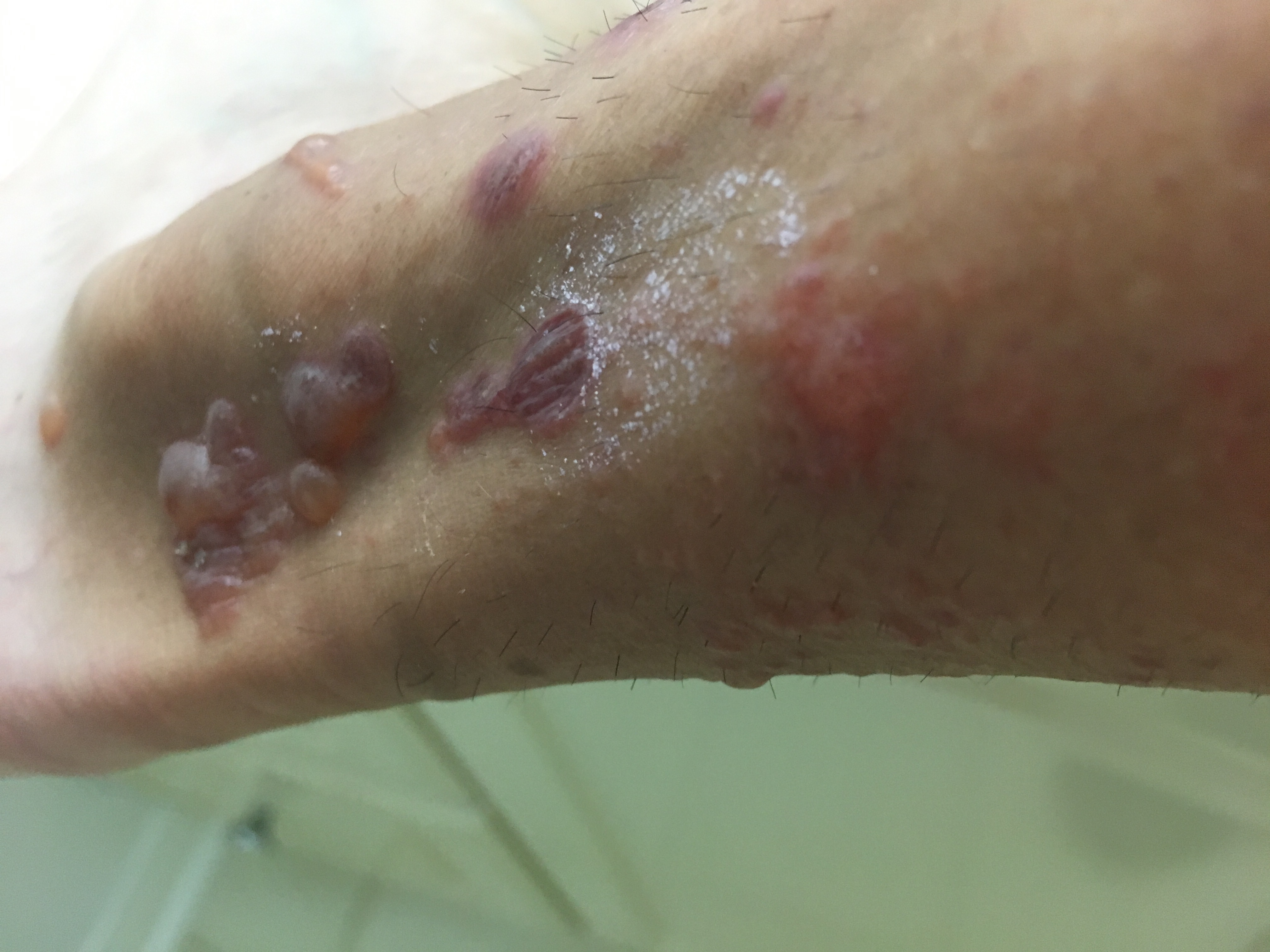 Poisonous to Touch Weed Series: Poison Ivy (Toxicodendron radicans and ...